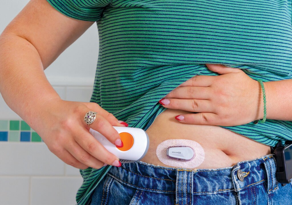 Dexcom G6 Téléphone Compatible : Guide Complet 2025 pour Diabétiques ...